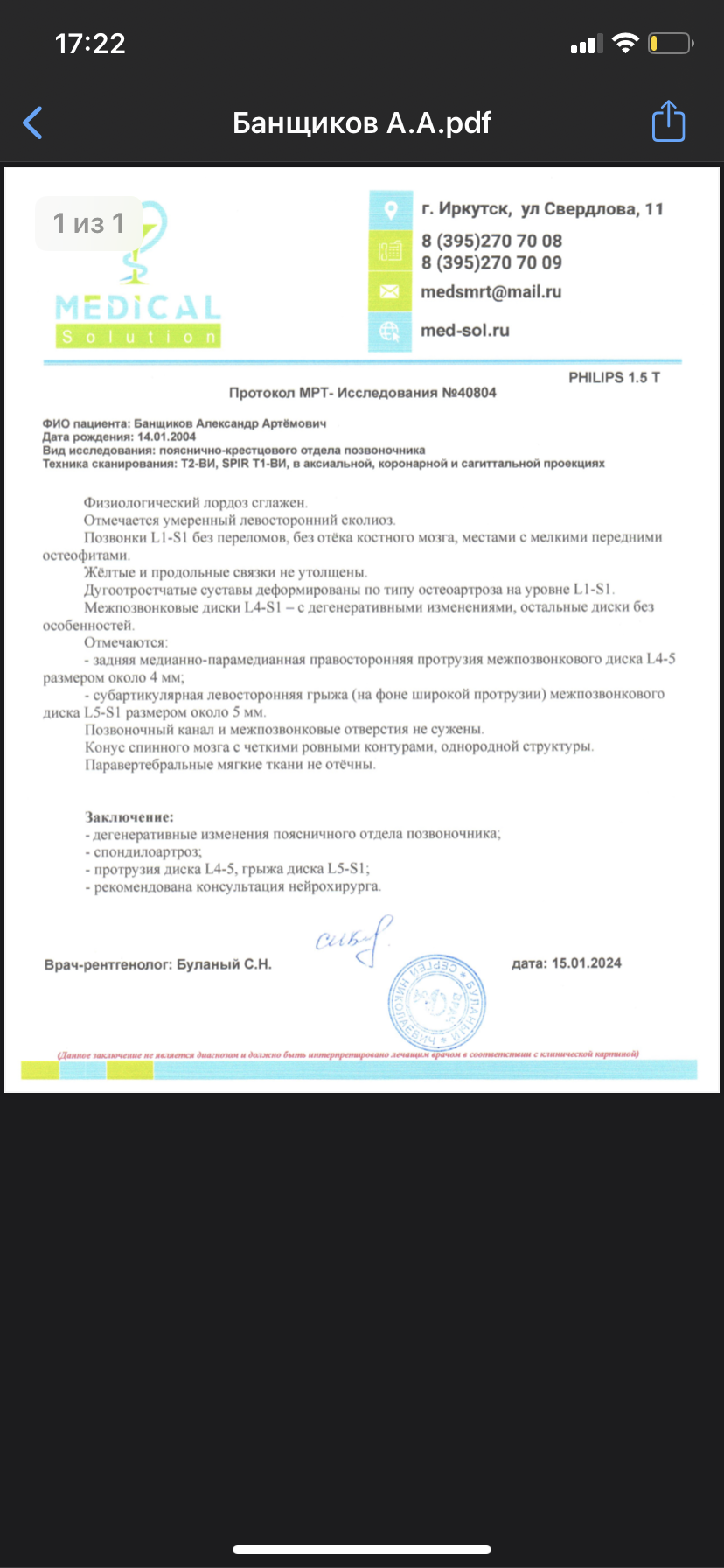 Ответы Mail Слабость в ноге и ощущение тепла в правой стопе